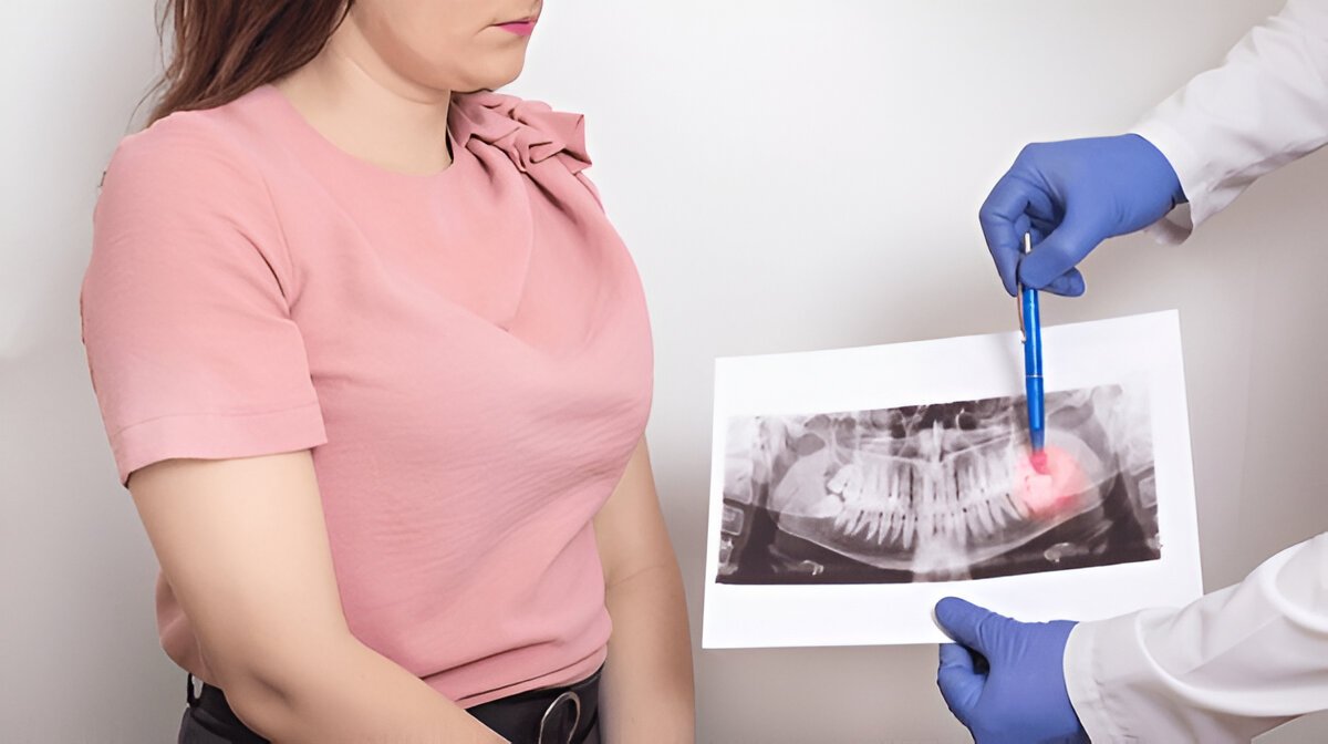 Wisdom Teeth Extraction Near Me in Downtown Edmonton, AB